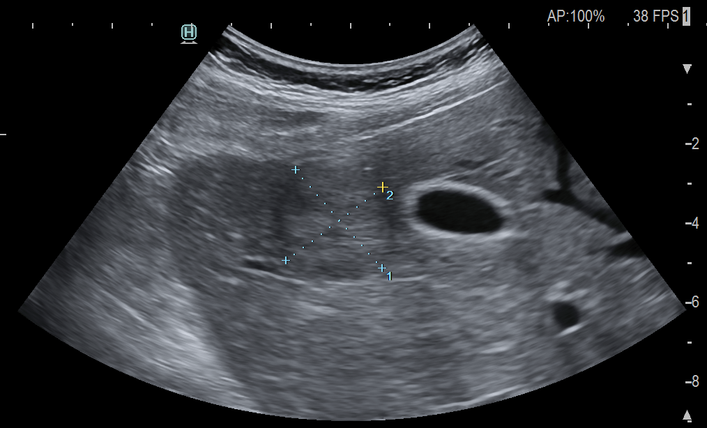 Flashcards – GastroCloud